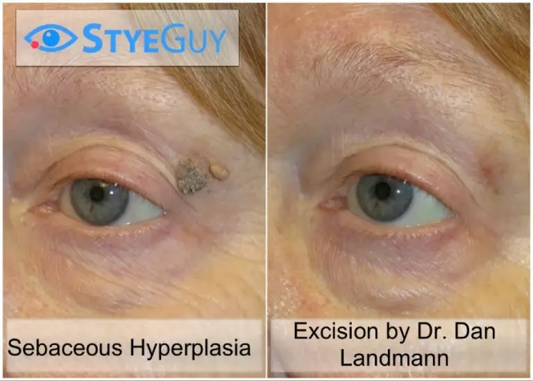 Gallery | Before & After Photos | River Edge, NJ