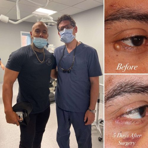 Eyelid Surgery | Stye Relief | River Edge, NJ